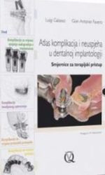 Atlas Komplikacija I Neuspjeha U Dentalnoj Implantologiji Od Luigi Galasso, Gian Antonio Favero