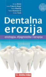 Dentalna Erozija: Etiologija, Dijagnostika I Terapija Od Grupa Autora