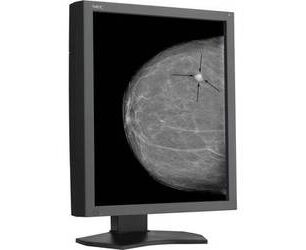 NEC 21" Grayscale 5-Megapixel Medical Diagnostic Monitor