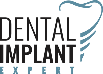 Dental Implant Expert