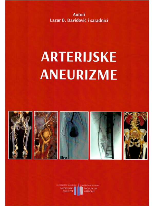 Arterijske aneurizme