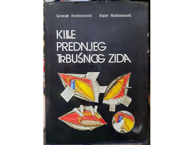 Kile prednjeg trbušnog zida