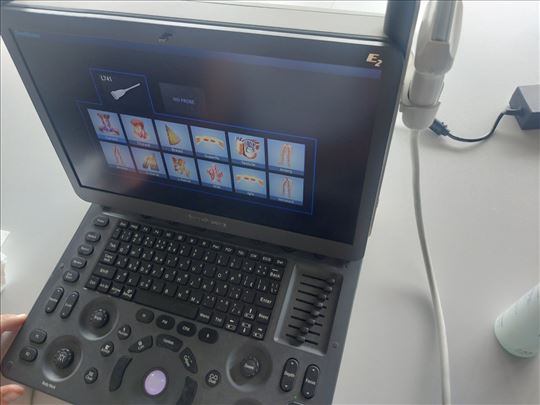 Portabl ultrazvučni aparat SonoScape E2