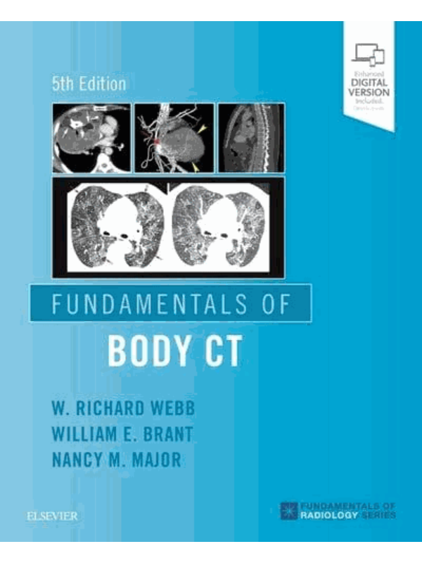 Fundamentals of Body Ct