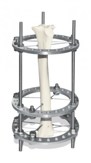 IMEX Circular ESF System - Standard