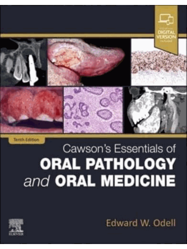 Cawson’s Essentials of Oral Pathology and Oral Medicine, 10th Edition