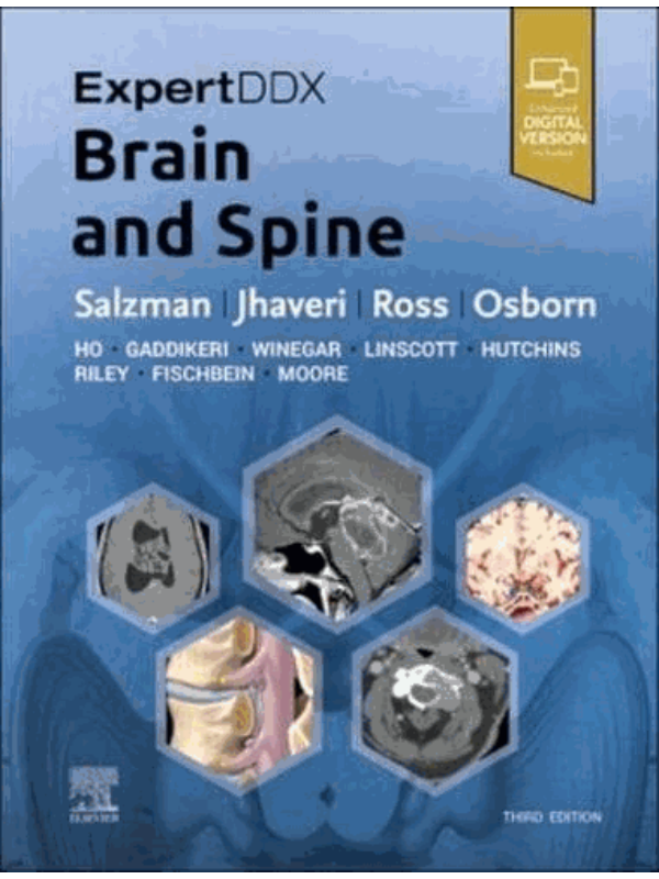 ExpertDDx: Brain and Spine, 3rd Edition