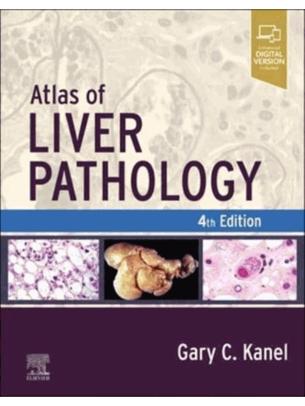 Atlas of Liver Pathology, 4th Edition