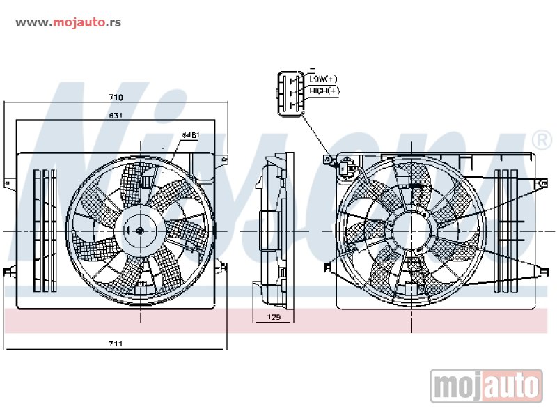 Ventilator