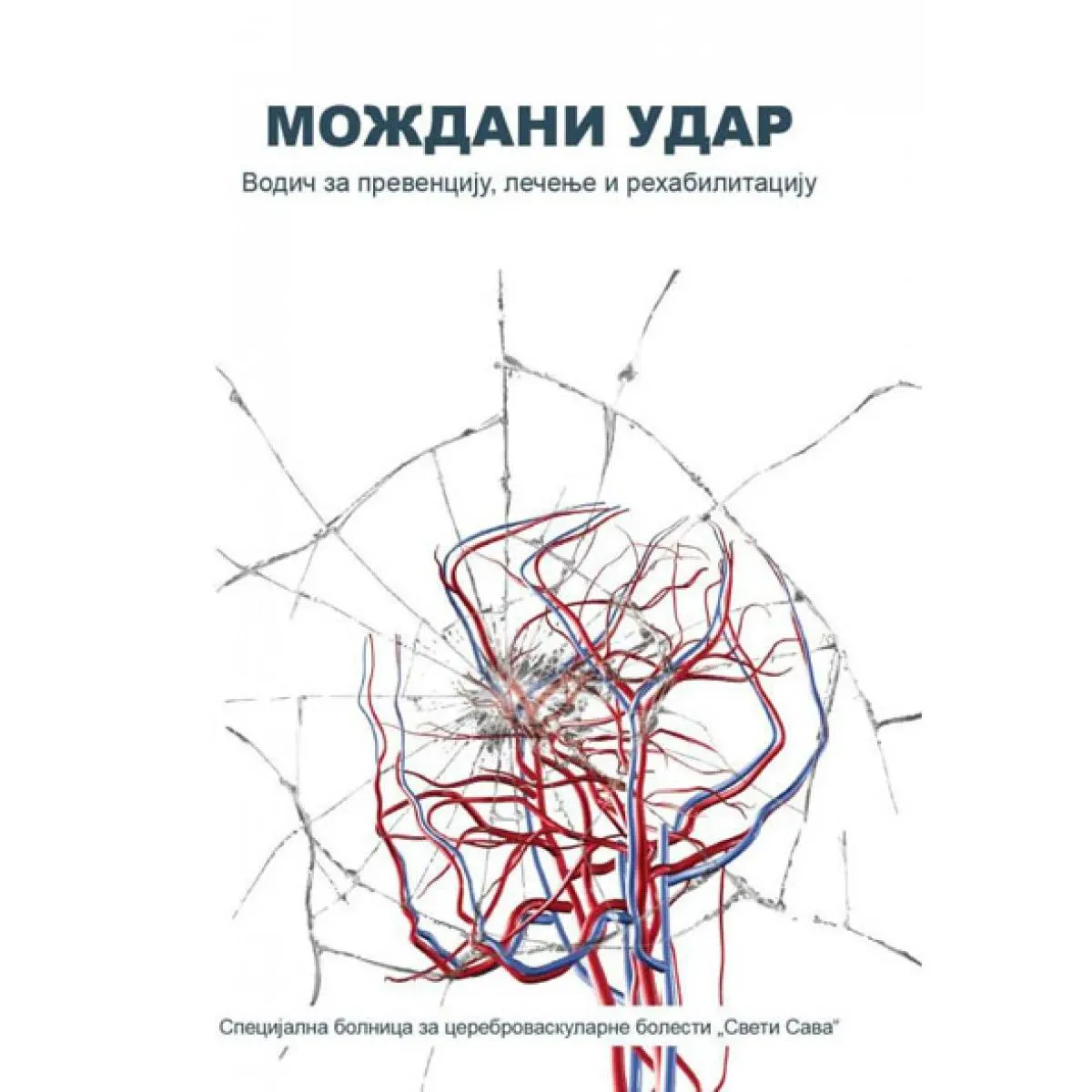 MOŽDANI UDAR Vodič za prevenciju lečenje i rehabilitaciju