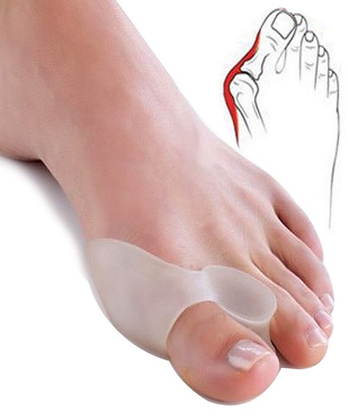 Anatomski Štitnik Za Čukljeve Hallux Valgus