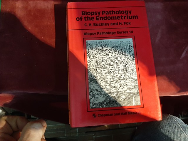 170 Biopsy Pathology of the Endometrium by Harold Fox