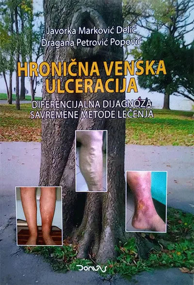 Hronična venska ulceracija-diferencijalna dijagnoza