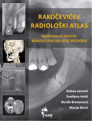 RAKOČEVIĆEV RADIOLOŠKI ATLAS PATOLOGIJE DENTO-MAKSILOFACIJALNOG REGIONA