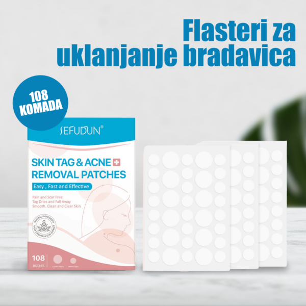 Flasteri za uklanjanje bradavica 108 komada