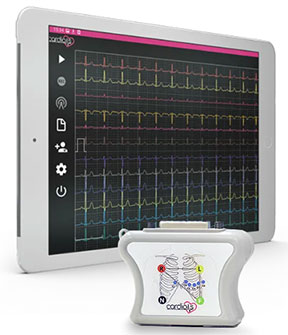 EKG Cardions, mobilni 12-kanalni aparat