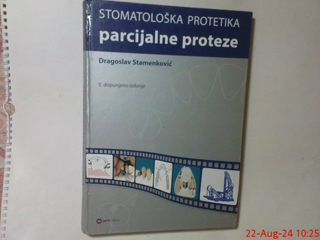 STOMATOLOSKA PROTETIKA - PARCIJALNE PROTEZE - DRAGOSLAV