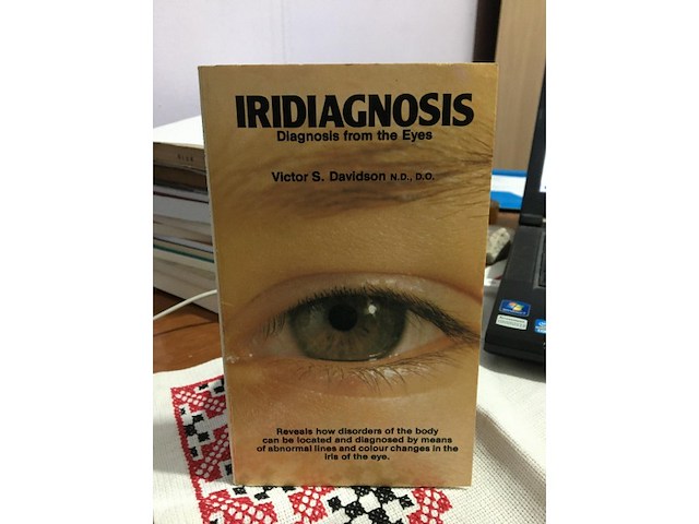 Iridiagnosis-Diagnosis from the eyes