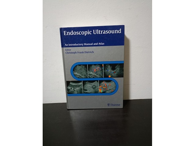 Endoscopic Ultrasound