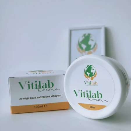 VITILAB KREMA ZA VITILIGO