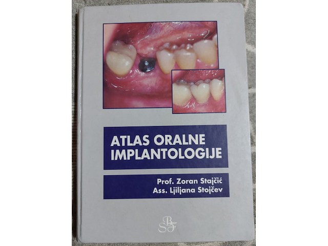 Atlas oralne implantologije- Z.Stajčić/ Lj.Stojčev