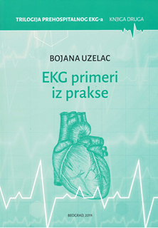 EKG primeri iz prakse