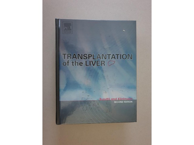 Transplantation of the liver Second Edition