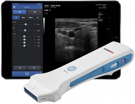 New SONON 300L Wireless, App-based Ultrasound System