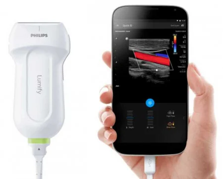 Philips Lumify Portable Ultrasound