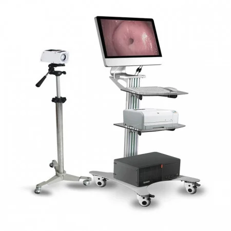 Digitalni Kolposk-Digital Electronic Colposcope Trolley Type MSLCE20op