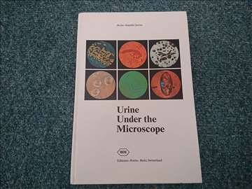 Urine Under the Microscope - Roche Laboratories