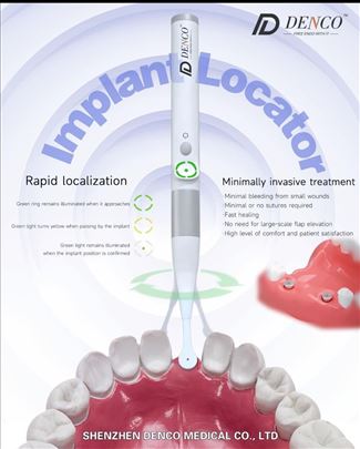 Implant lokator