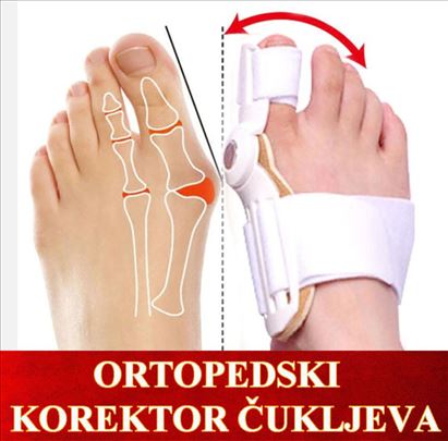 Ortopedski korektor čukljeva