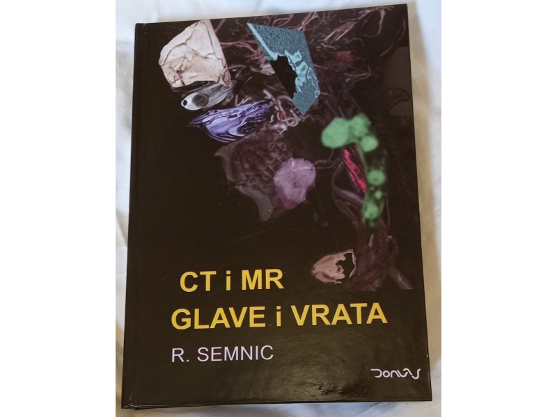 CT i MR glave i vrata