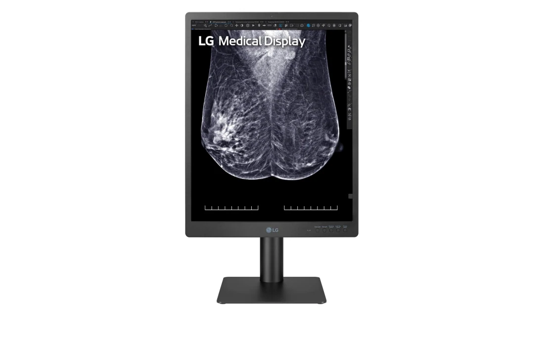LG IPS dijagnostički monitor za mamografiju od 21,3 inča i 5 MP
