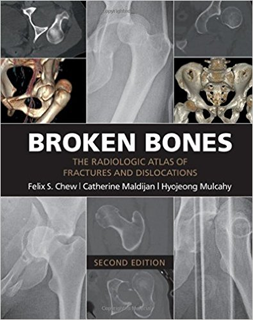 Broken Bones: The Radiologic Atlas of Fractures and Dislocations, 2 Ed