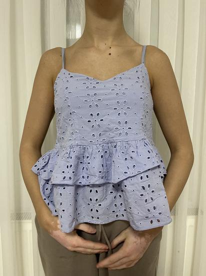 Top