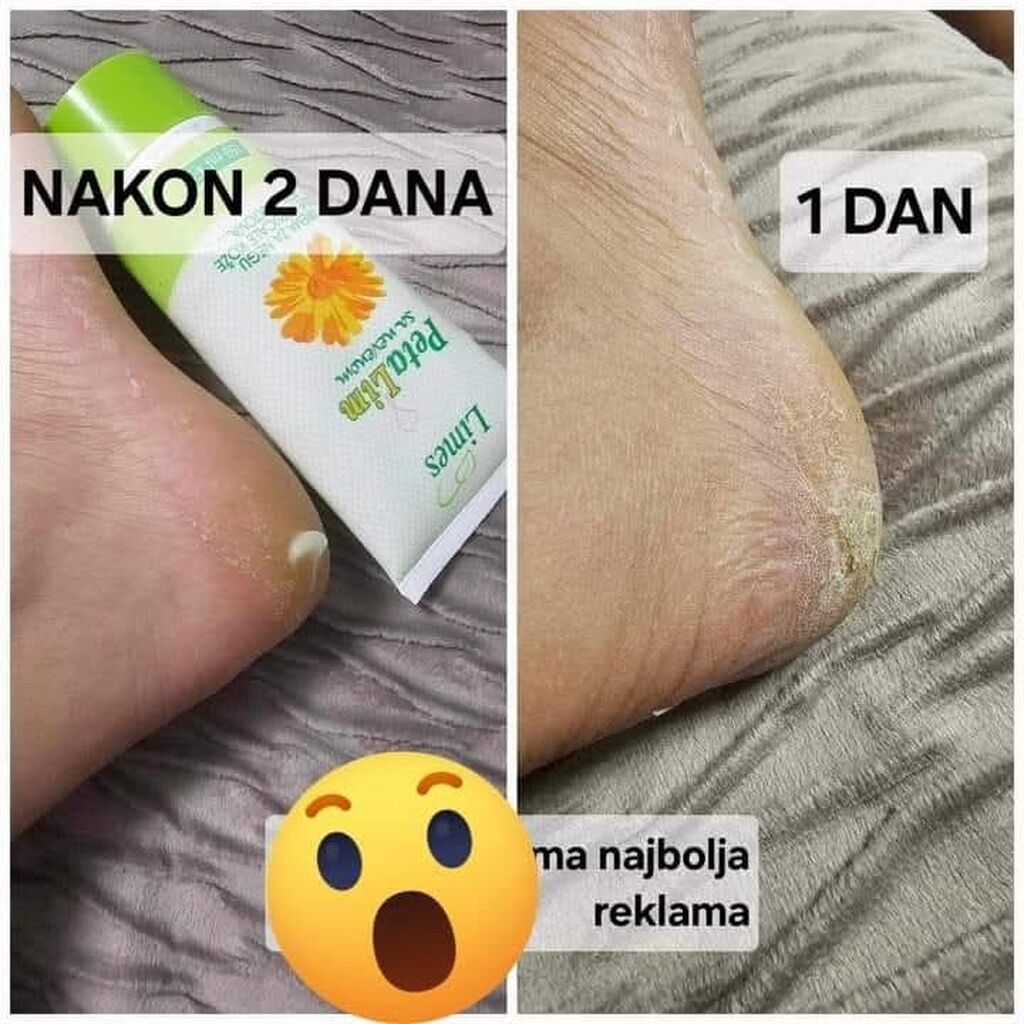 Zadovoljni kupci su naša najbolja reklama