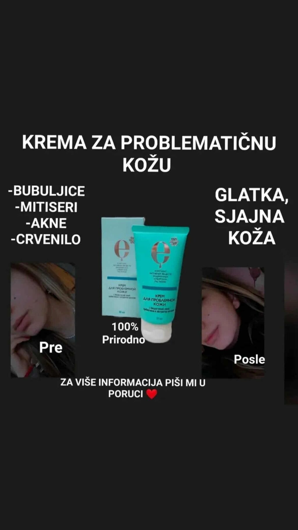 Experalta kozmetika – nega za problematičnu i zrelu kožu - Krema za