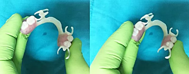BIO DENTAPLAST PROTEZA