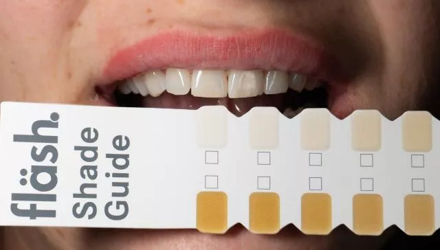 IZBELJIVANJE ZUBA TREJOM (KUĆNA VARIJANTA) - DENTAL VORTEX