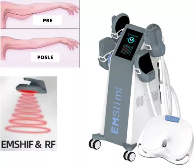 Kozmetički aparat sa 4 ručke