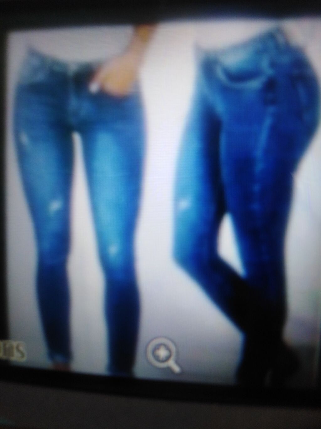 Teksas, Normalan struk, Skinny