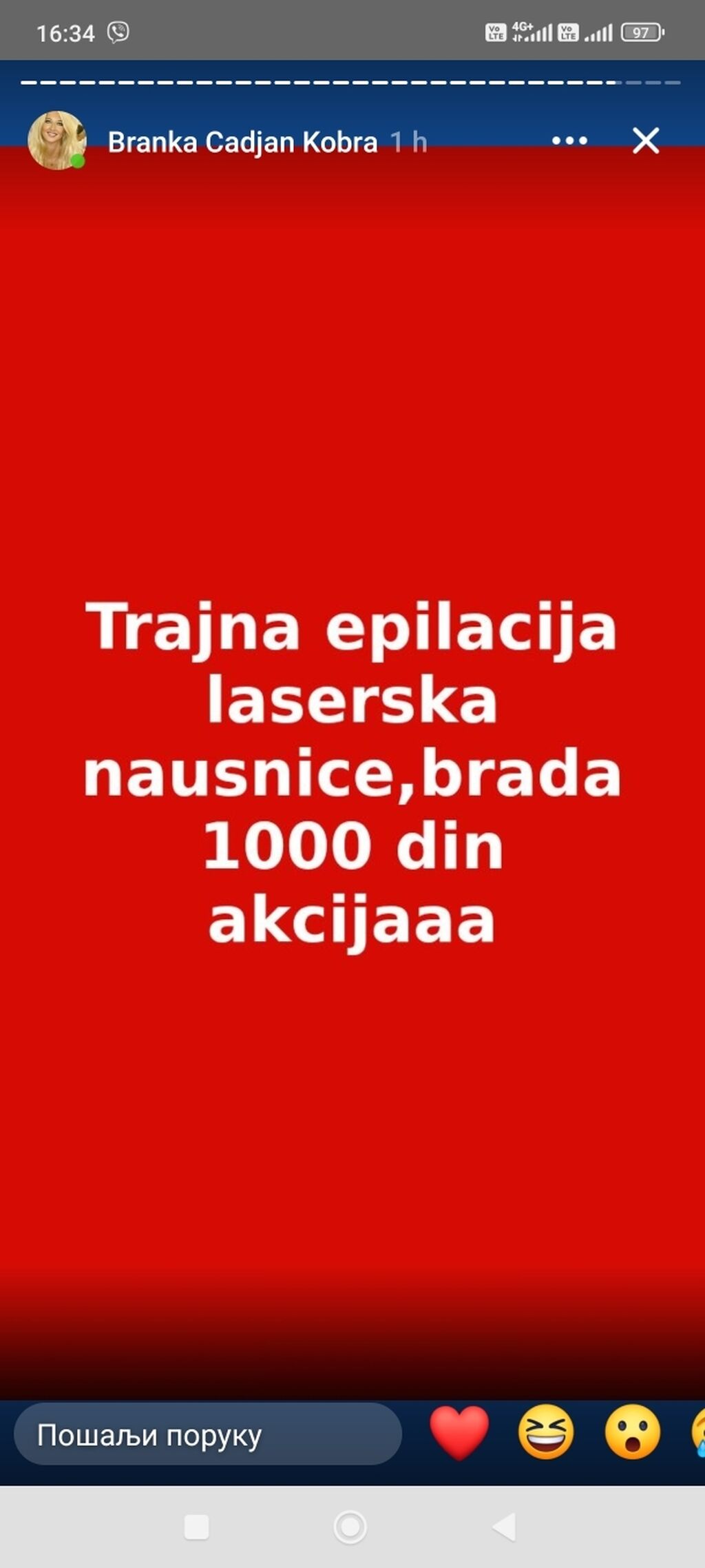 Laserska trajna epilacija – akcijske cene: - Nausnice i brada: 1.000