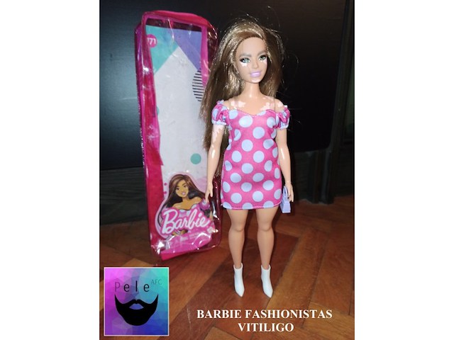 Barbie Fashionistas Vitiligo - TOP PONUDA