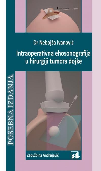 Intraoperativna ehosonografija u hirurgiji tumora dojke: Intraoperative echosonography in breast tumors surgery