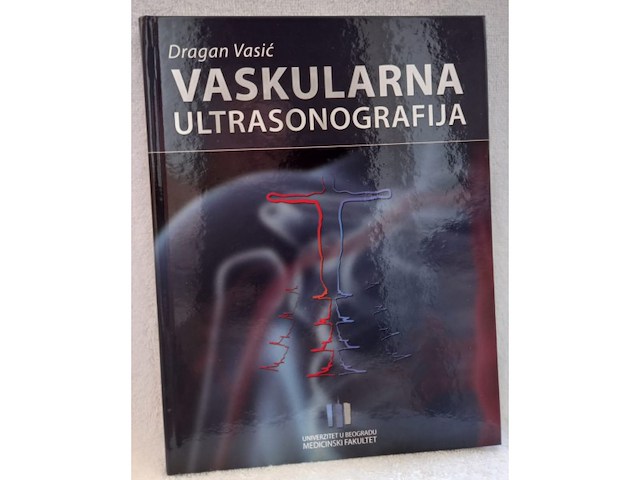 Vaskularna ultrasonografija