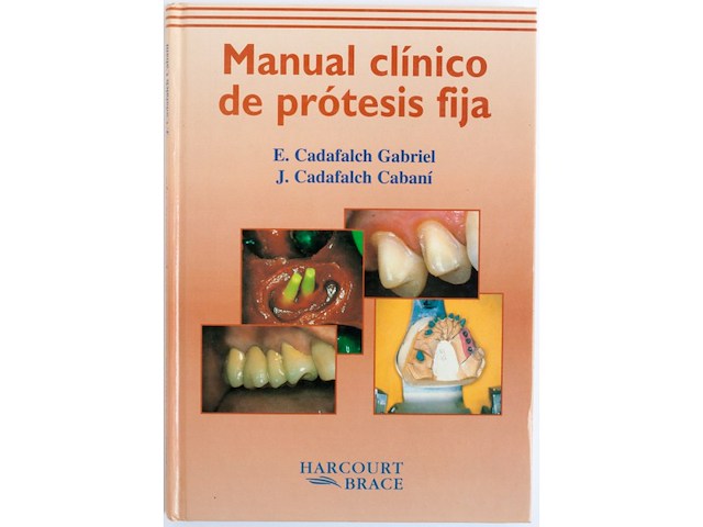 Manual Clínico de Prótesis Fija, E. Cadafalch Gabriel