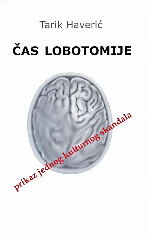 Čas lobotomije : Prikaz jednog kulturnog skandala