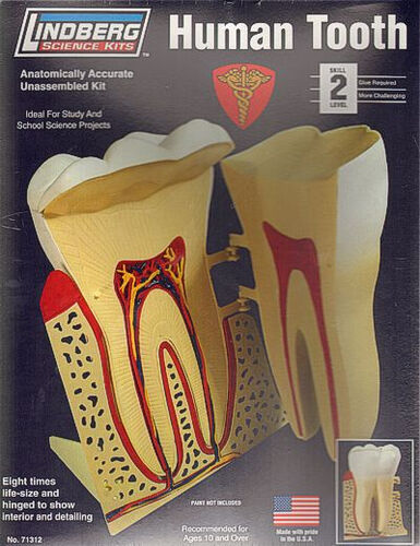 Lindberg 71312 Human Tooth - Eight times life size